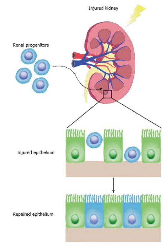 The Big Question | Can Kidney Disease Be Reversed? | Kidney Coach
