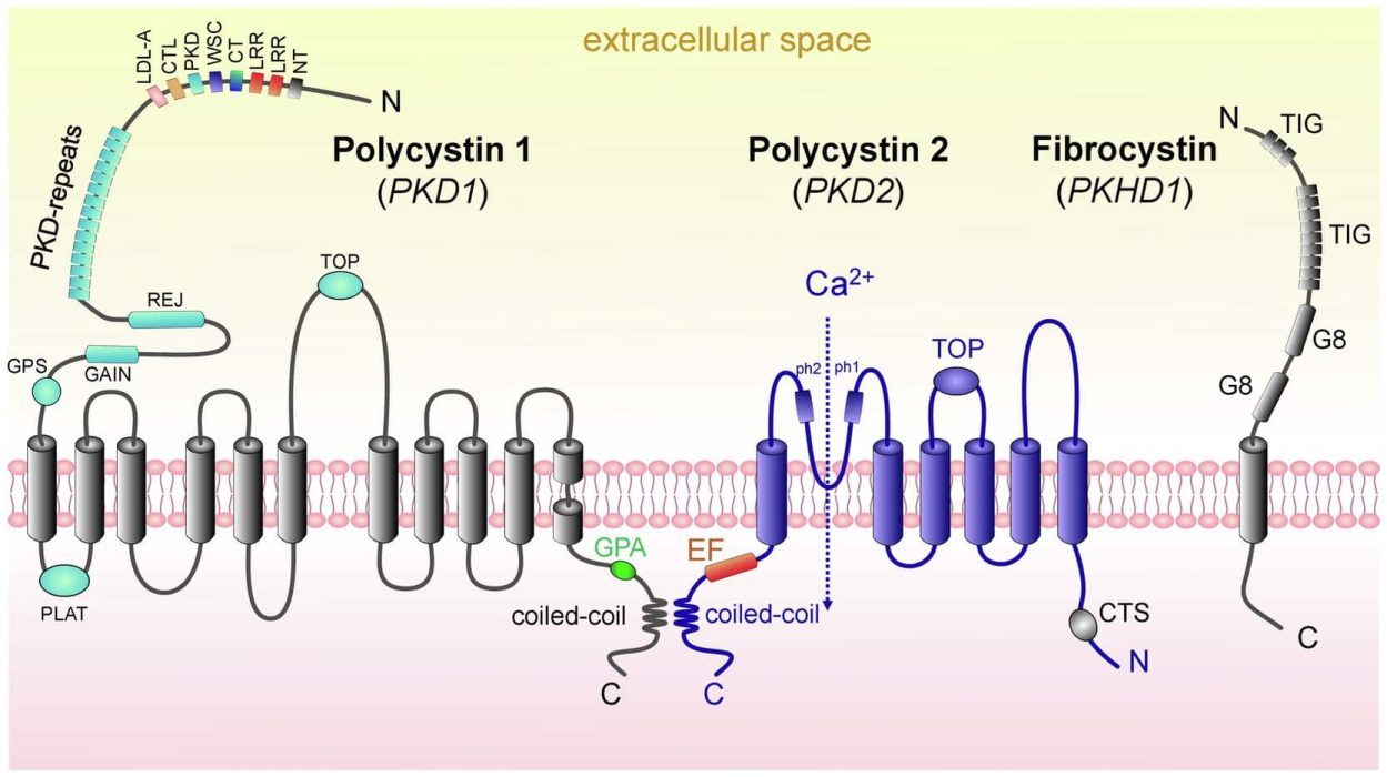 What Causes Cyst Formation In Polycystic Kidney Disease? | Kidney Coach