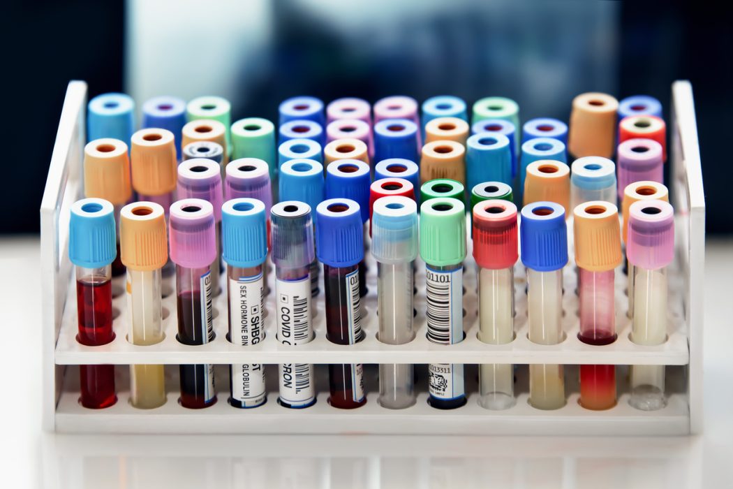 Pathology Testing for Chronic Kidney Disease | Kidney Coach